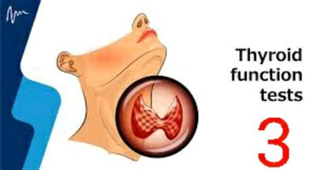 Bassam Al Harazi On Linkedin Thyriod Function Test Interpretation 3 Ft3 Ft4 Normal Tsh Low