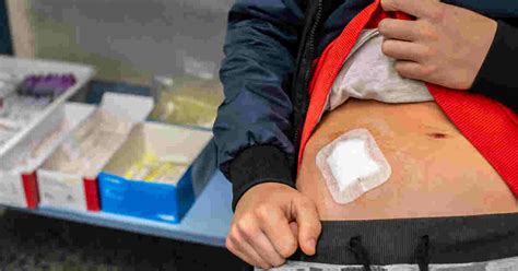 What Are The Post Operative Recommendations For Appendectomy Thip Media