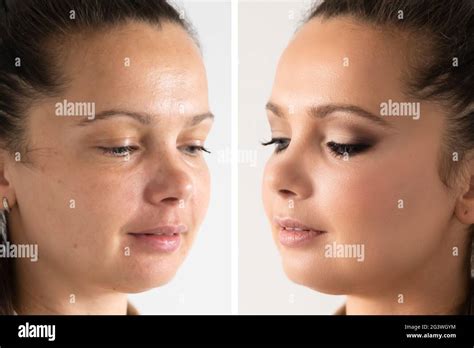 Woman Face Skin Make Up Comparing Before And After Stock Photo Alamy