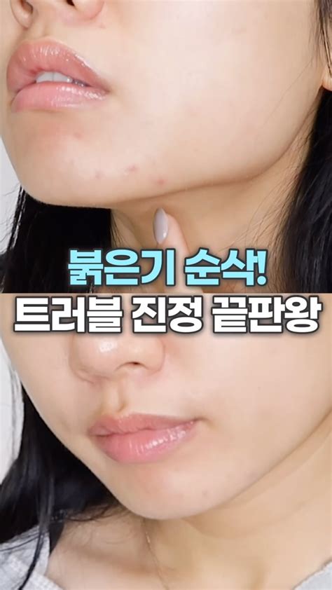 막퍼주는 뷰티 꿀팁and리뷰 쎄이 트러블진정 끝판왕 마데카분말🌿민감피부 인생템 등극 올영추천템 올리브영추천템 스킨케어