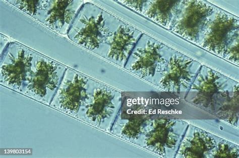 Spirogyra Green Algae Spiral Chloroplast Nucleus Cell Wall Living High