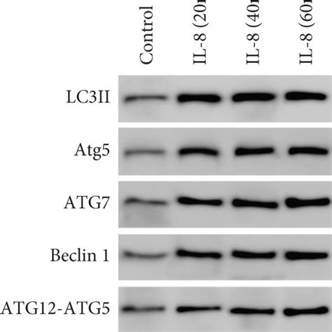 Autophagy Markers And Atg12 Atg5 Protein Expression Were Affected By