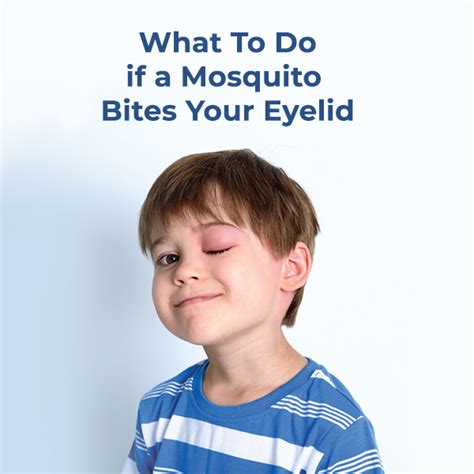 Mosquito Bite Allergy Eye