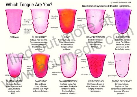 Tongue Chart Tongue Health Liver Health Tongue