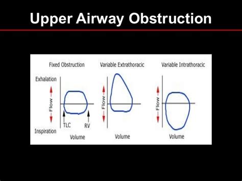 Pulmonary Function Testing Pulmonary Function Testing