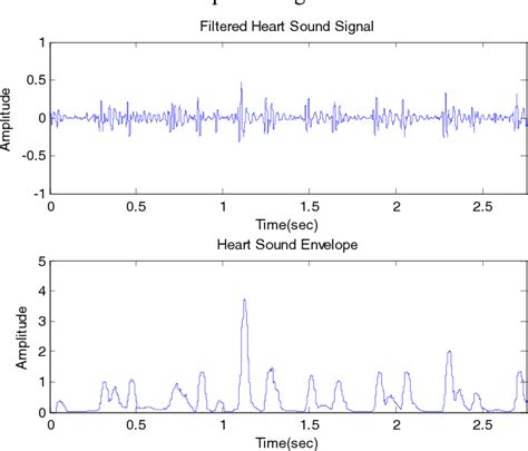 Figure 1 From An Adaptive Real Time Method For Fetal Heart Rate Extraction Based On