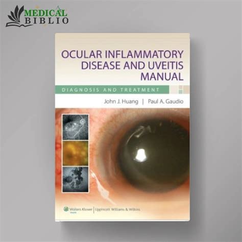 Ocular Inflammatory Disease And Uveitis Manual Diagnosis And Treatment