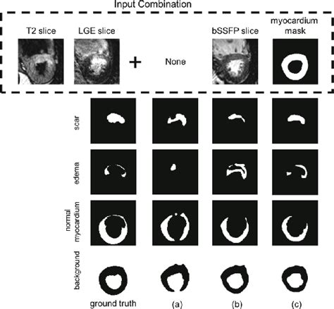 Examples Of Segmentation Results By Adopting Different Input