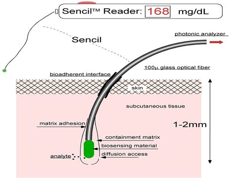 Illustration Of Biosensor And Its Implantation Position Relative To A