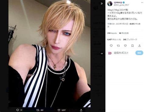「乳首切除」で騒然の男性ギタリスト、左手に「マイクロチップ」埋め込む 体内から青く発光「出来ること結構あって便利です」 J Cast ニュース