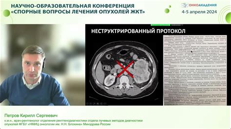МРТ в диагностике рака прямой кишки разбор наиболее типичных ошибок