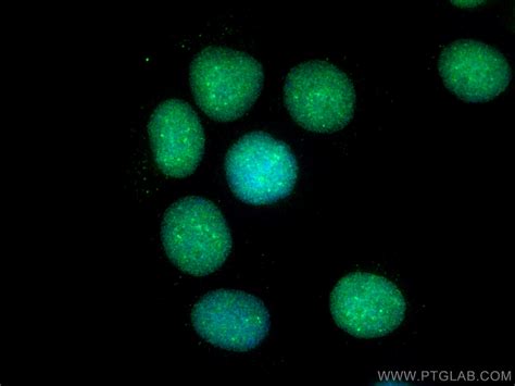 Sumo1 Antibody 10329 1 Ap Proteintech