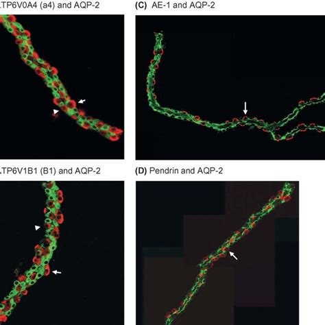 Ad Electron Micrographs Of Mouse Tubules Obtained By Digestion Of