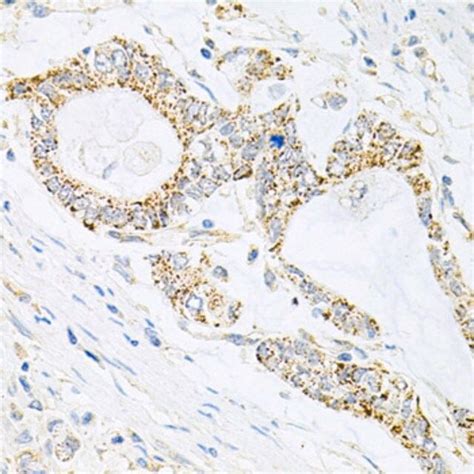 Anti Irs Antibody Produced In Rabbit