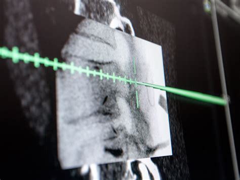 Спинальная навигация Евромедмаркет официальный дистрибьютор Brainlab в России с 2012 года