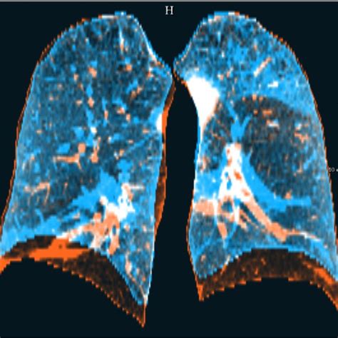 Illustration Of Registration Results Here Dir Lab Case 08 Download Scientific Diagram