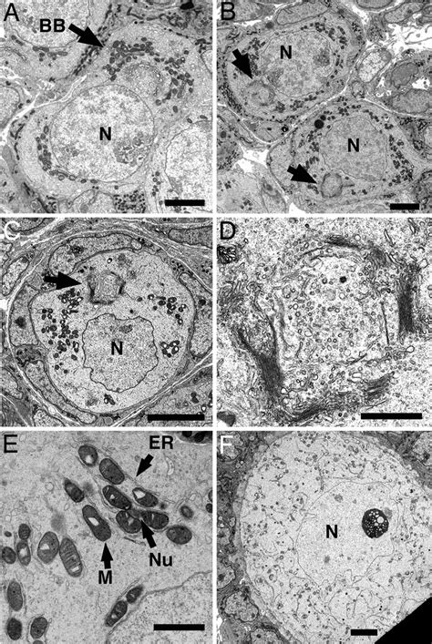 Electron Micrographs Of Oocytes In Neonatal Ovaries A Micrograph Of