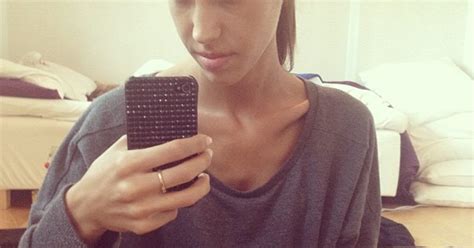 Teen Girl Shares Road To Anorexia Recovery On Instagram R