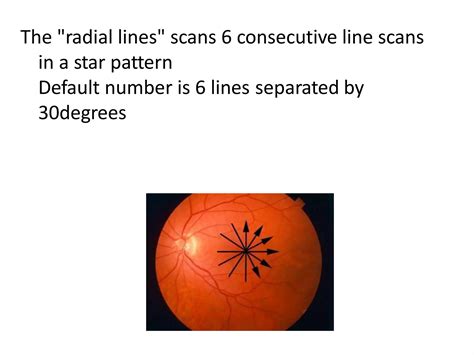 Optical Coherence Tomography Oct Macula Pptx