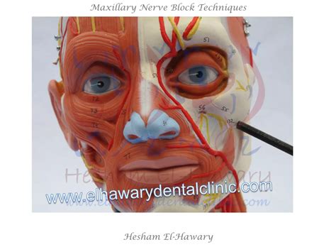 Maxillary Nerve Block Anesthetic Technique With Photos Pdf