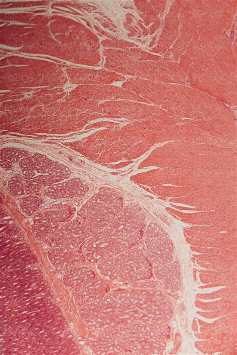 Pyloric Region