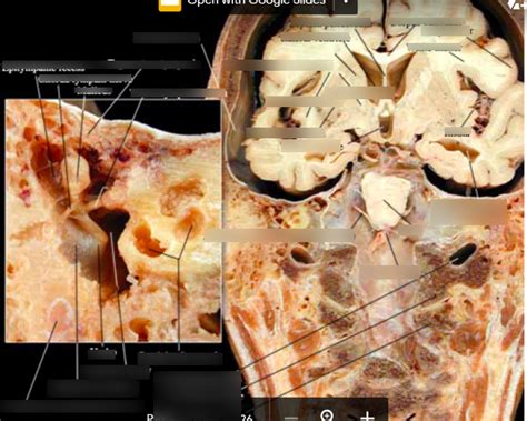 Cadaver 12 Diagram Quizlet