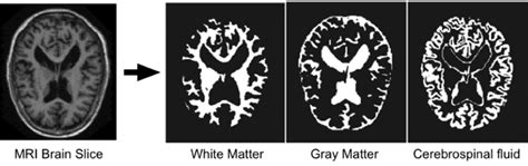 Deep Learning In Medical Imaging 3d Medical Image Segmentation With Pytorch Ai Summer