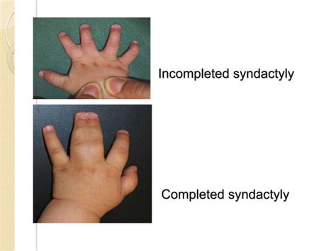 Congenital And Developmental Anomalies2560