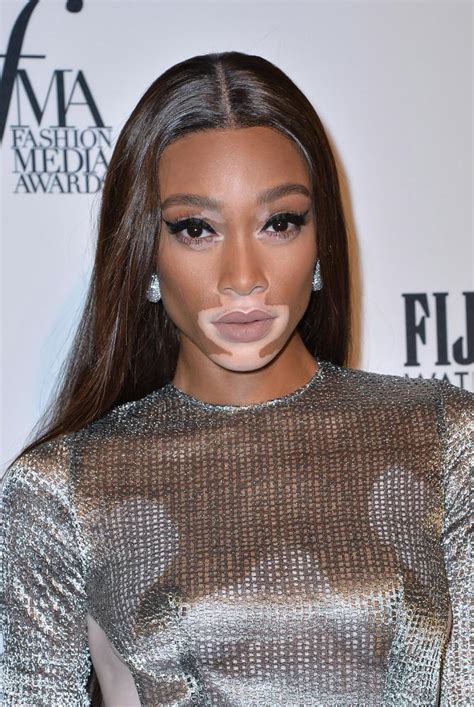 Winnie Harlow Model Actress