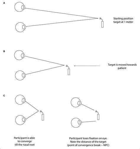 Testing For Convergence Insufficiency At The Starting Position A
