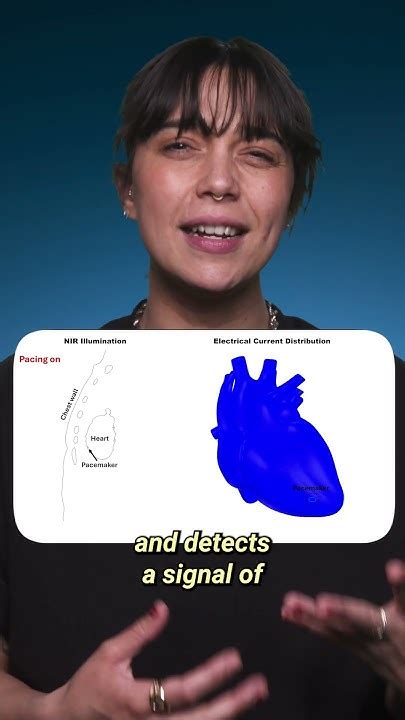 Tiny Pacemaker Developed By Scientists Can Fit In A Syringe Youtube