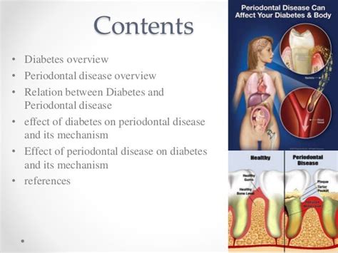 Diabetes And Periodontal Disease At Two Way Relationship