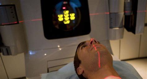 Cuáles son los efectos de la radioterapia