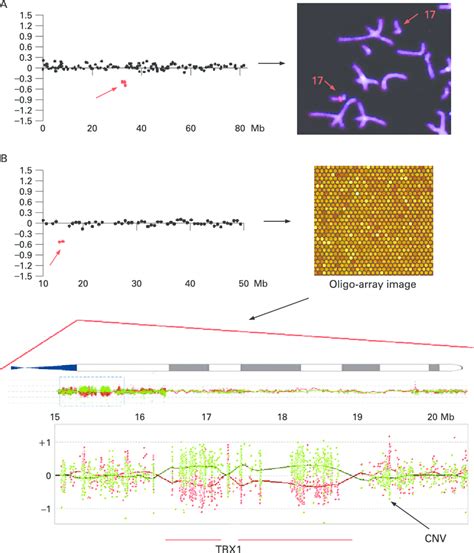 this figure shows the detection by array based comparative genomic