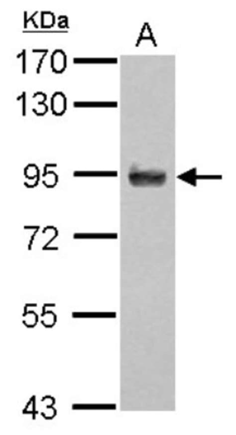 Apbb2 01 Ml