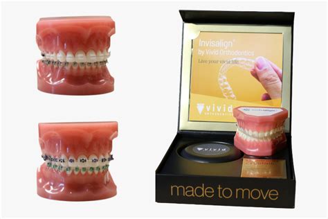 Braces Vs Aligners