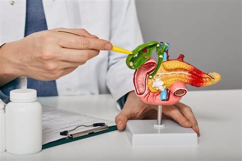 Top 19 dieta para quem não tem vesícula 2022
