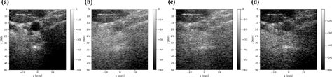 Figure 1 From A Robust Deep Neural Network Approach For Ultrafast Ultrasound Imaging Using