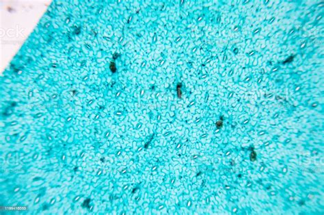 Cerrar Epidermis Vegetal Con Estomas O Epidermis De Hoja Bajo
