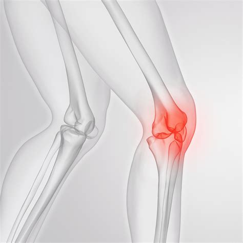 Traumeel Ontsteking Sport En Voeding