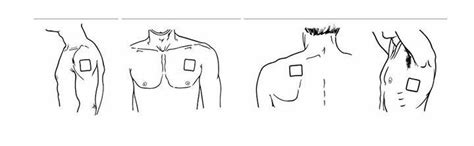 Buprenorphine Patch Package Insert