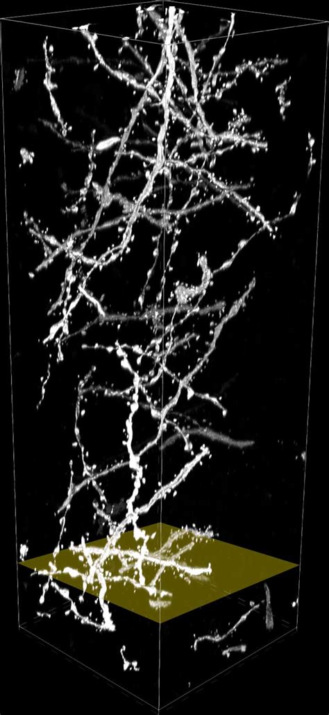 AX AX R With NSPARC AX AX R With NSPARC Confocal And Multiphoton Microscopes