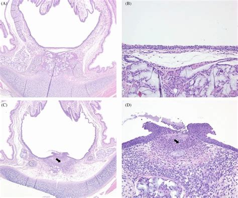 Histopathology Of The Larynx Of Male Rats Exposed To Nadcc A B No