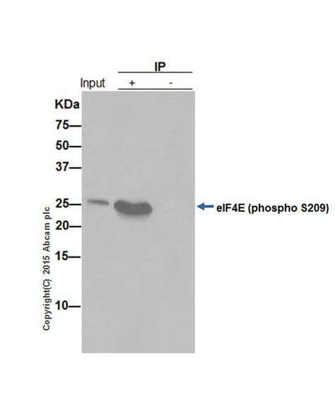Anti Eif4e Phospho S209 Antibody Ep2151y Ab76256 Abcam