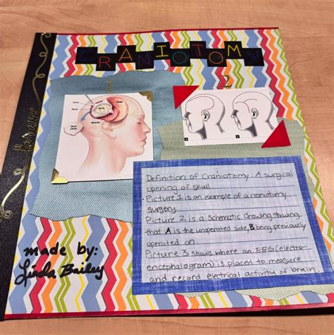 Craniotomy Surgery Human Steam