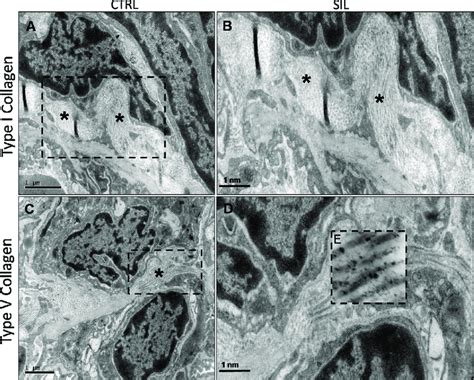 Electron Microscopy Assessment In Silica Induced Lung Granuloma