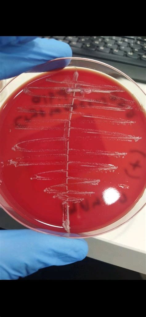 Cryptococcus Albidus Is An Encap Sulated Yeast That Is Rarely