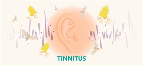 How To Know If You Have Tinnitus Associated Audiologists