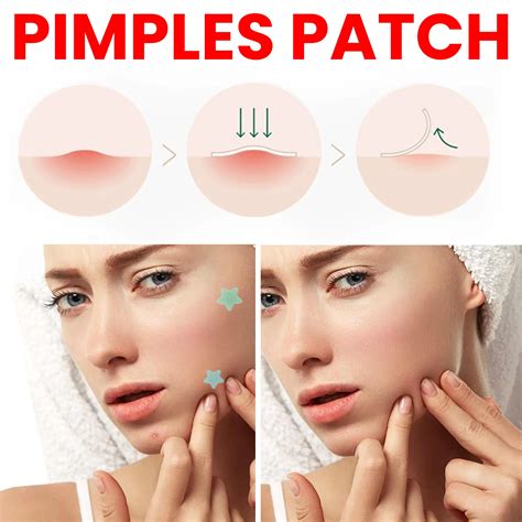 Jaysuing Pimple Patch Lighten Pimple Spots Repair Skin Acne Marks Blemish Cover Acne Pimple