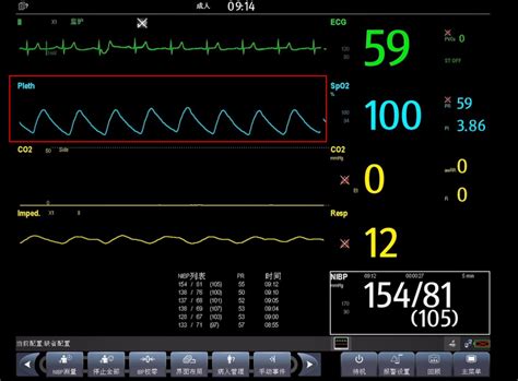Ppg Waveform Examples Of Patients With Hypertension Download